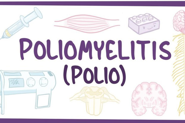 What are the Main Types of Poliomyelitis (Polio)? - Best Herbal Health